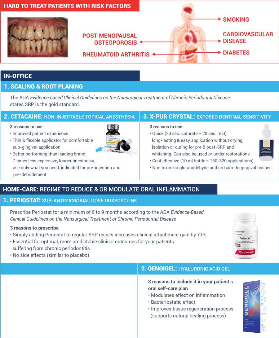 Periodontitis | Oral Science